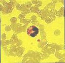 Comprobado las células bailan! El efecto de la música en nuestro cuerpo ...